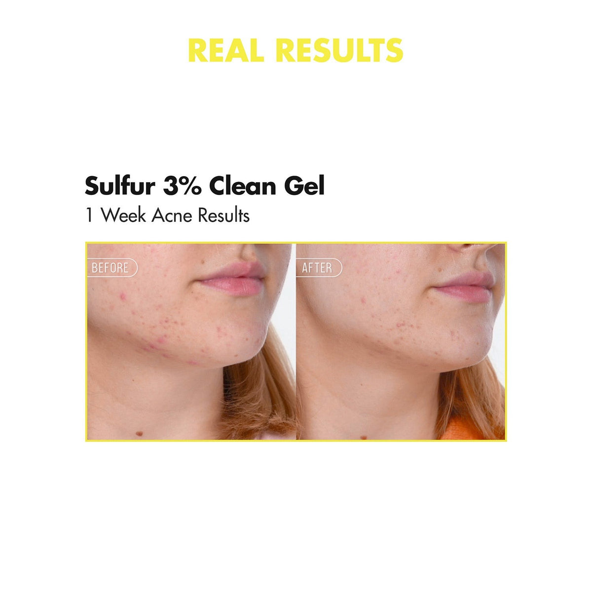 By Wishtrend Sulfur 3% Clean Gel 30g - Peaches & Cream